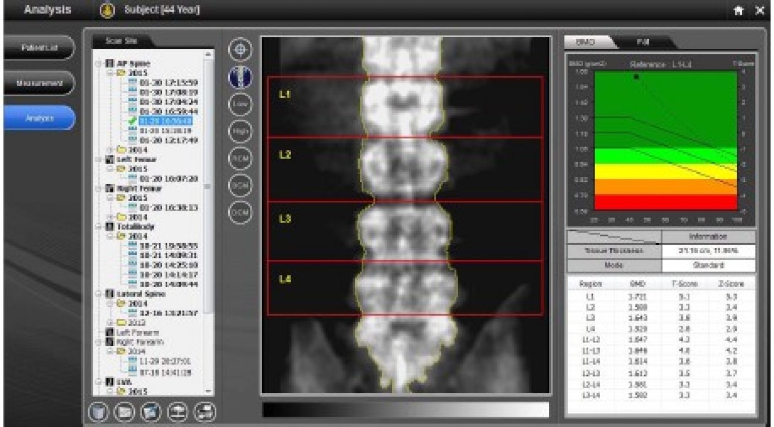 Osteodensitometru whole body Primus Osteosys – Doctorplus.ro