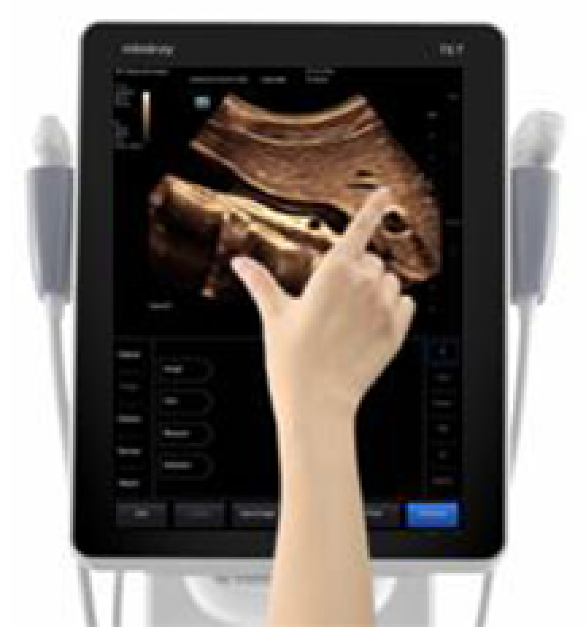 Ecograf tableta Mindray TE7 | Simplu, inteligent, focalizat – Doctorplus.ro